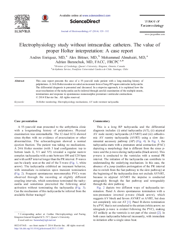(PDF) Electrophysiology study without intracardiac catheters. The value ...