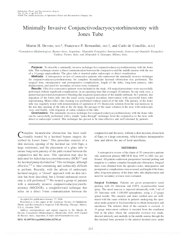 (PDF) Minimally Invasive Conjunctivodacryocystorhinostomy with Jones Tube