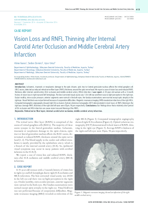 (PDF) Vision Loss and RNFL Thinning after Internal Carotid Arter ...
