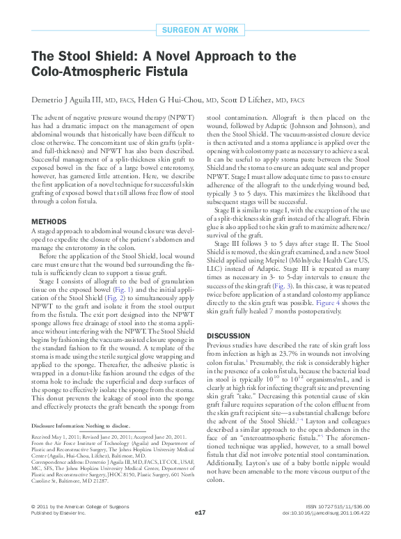 (PDF) The Stool Shield: A Novel Approach to the Colo-Atmospheric Fistula
