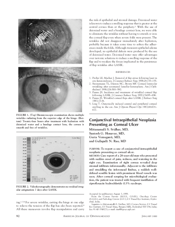 (PDF) Conjunctival intraepithelial neoplasia presenting as corneal ulcer