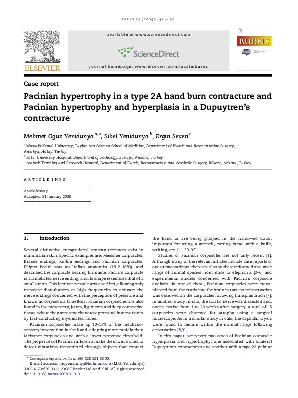 (PDF) Pacinian hypertrophy in a type 2A hand burn contracture and ...