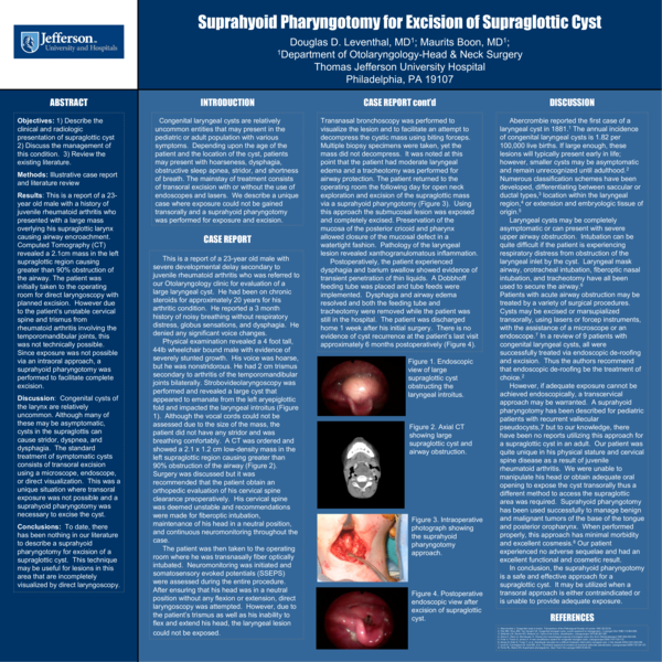 (PDF) Suprahyoid Pharyngotomy for Excision of Supraglottic Cyst
