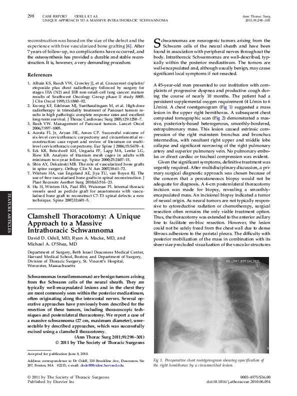 (PDF) Clamshell Thoracotomy: A Unique Approach to a Massive ...