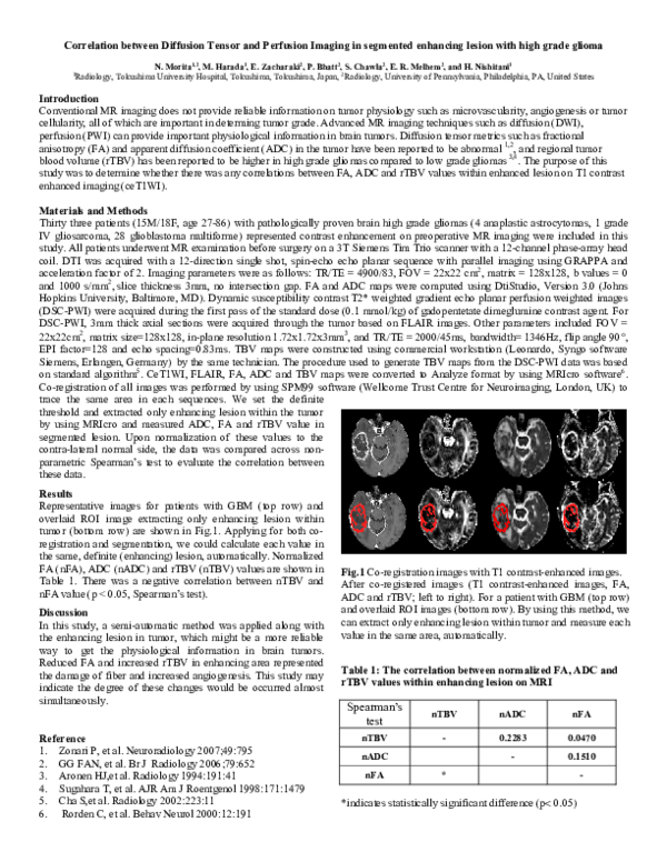 Pdf Correlation Between Diffusion Tensor And Perfusion Imaging In Segmented Enhancing Lesion