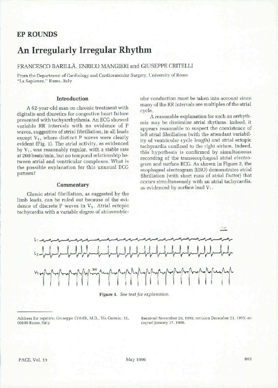 (PDF) An Irregularly Irregular Rhythm