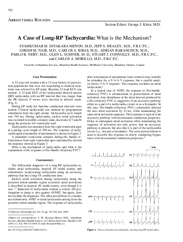 (PDF) A Case of Long-RP Tachycardia: What is the Mechanism?