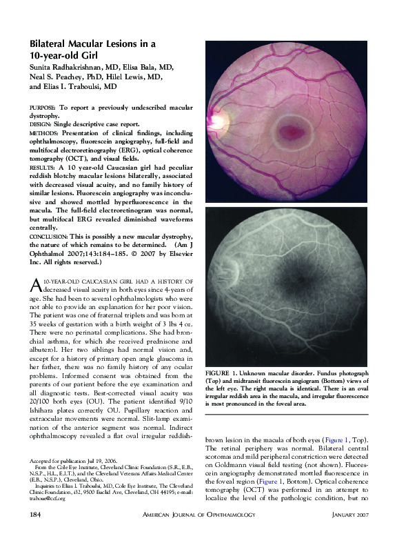 (PDF) Bilateral Macular Lesions in a 10-year-old Girl