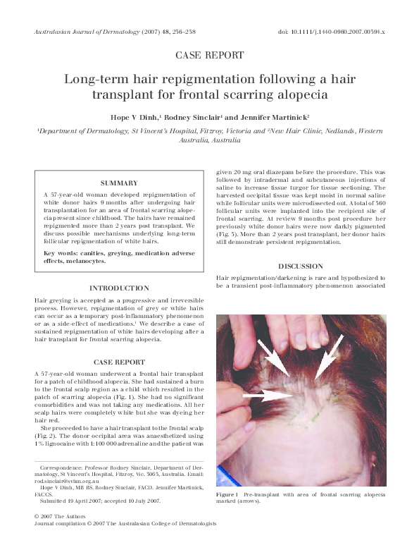 (PDF) Long-term hair repigmentation following a hair transplant for ...