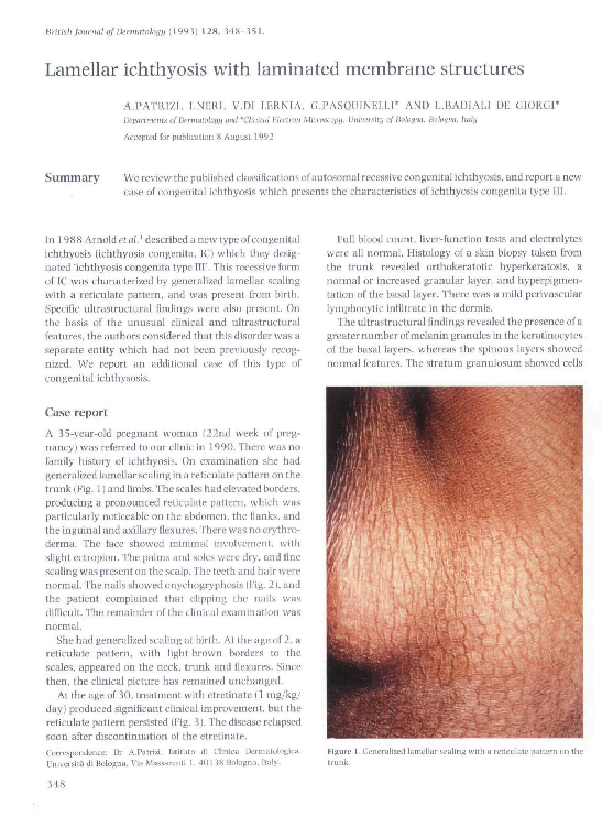 (PDF) Lamellar ichthyosis with laminated membrane structures