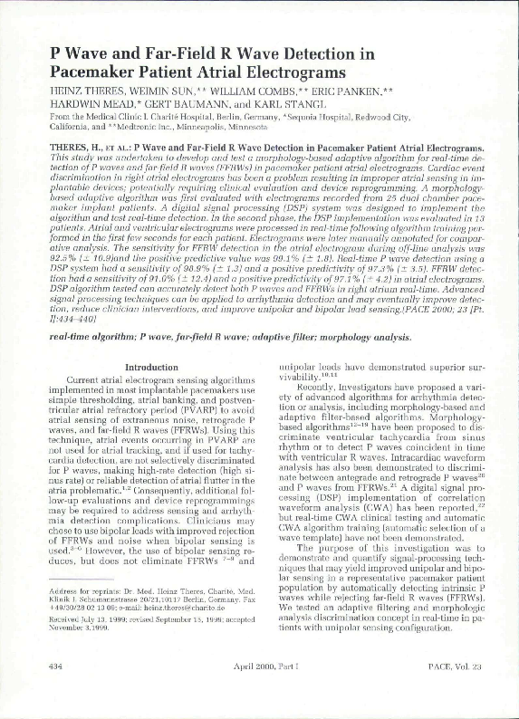 (PDF) P Wave and Far-Field R Wave Detection in Pacemaker Patient Atrial ...