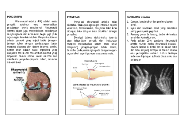 (DOC) leaflet rhematoid