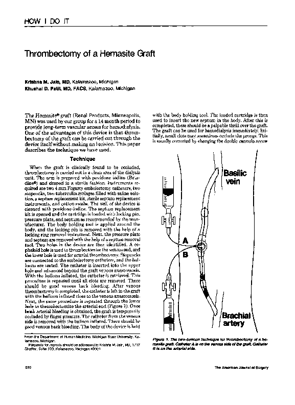 (PDF) Thrombectomy of a hemasite graft | Krishna Jain - Academia.edu