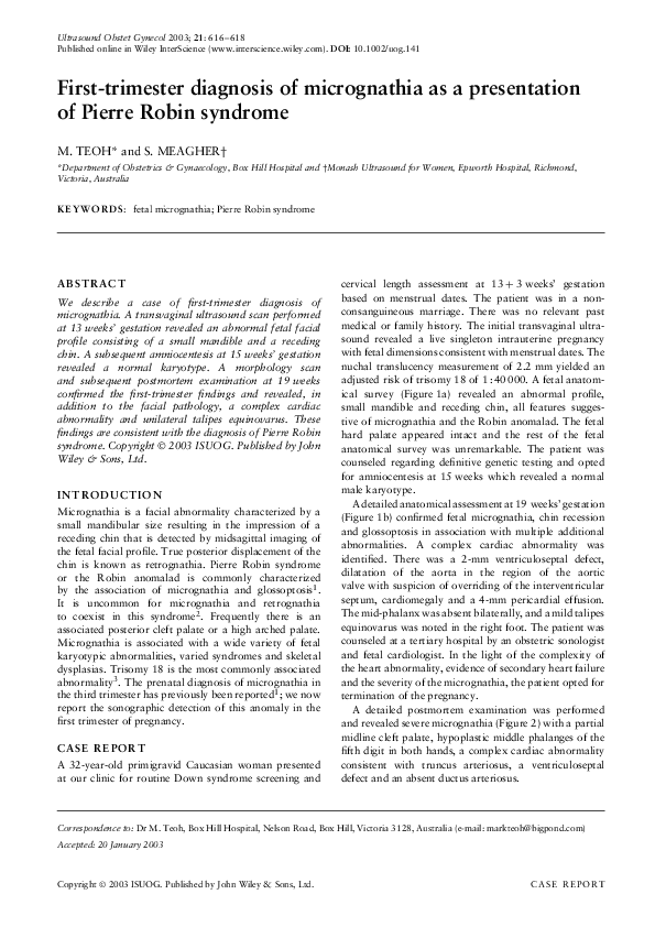 (PDF) First-trimester diagnosis of micrognathia as a presentation of ...