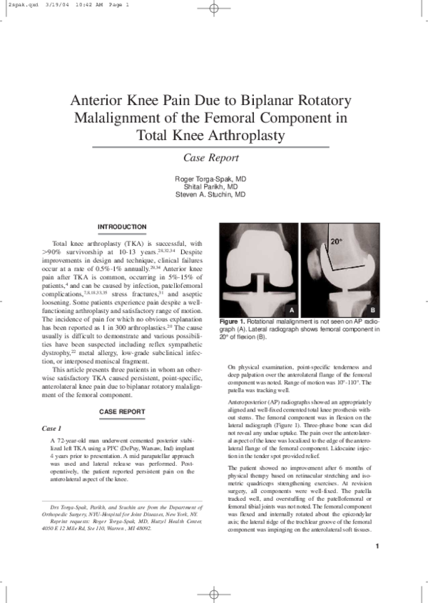 (PDF) Anterior knee pain due to biplanar rotatory malalignment of the ...