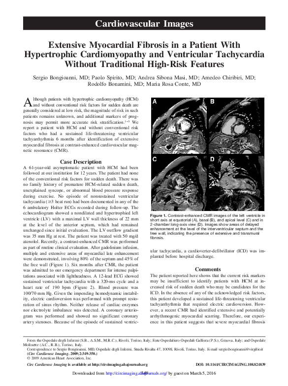 (PDF) Extensive Myocardial Fibrosis in a Patient With Hypertrophic ...