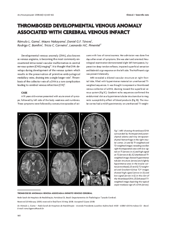 (PDF) Thrombosed developmental venous anomaly Associated with cerebral ...