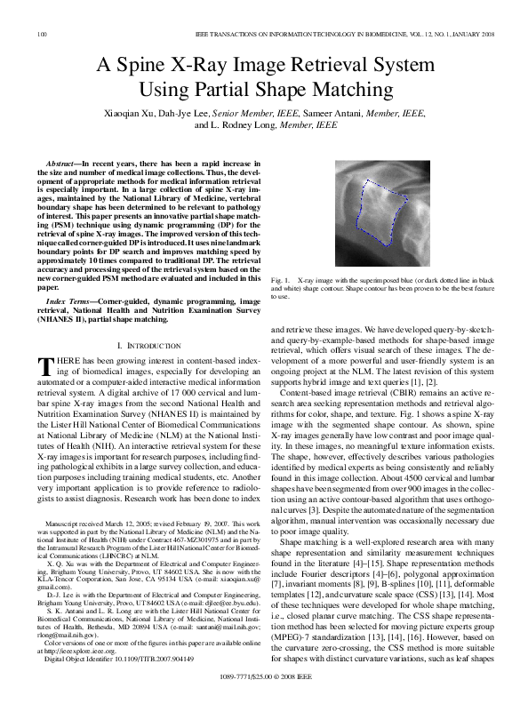 (PDF) A Spine X-Ray Image Retrieval System Using Partial Shape Matching