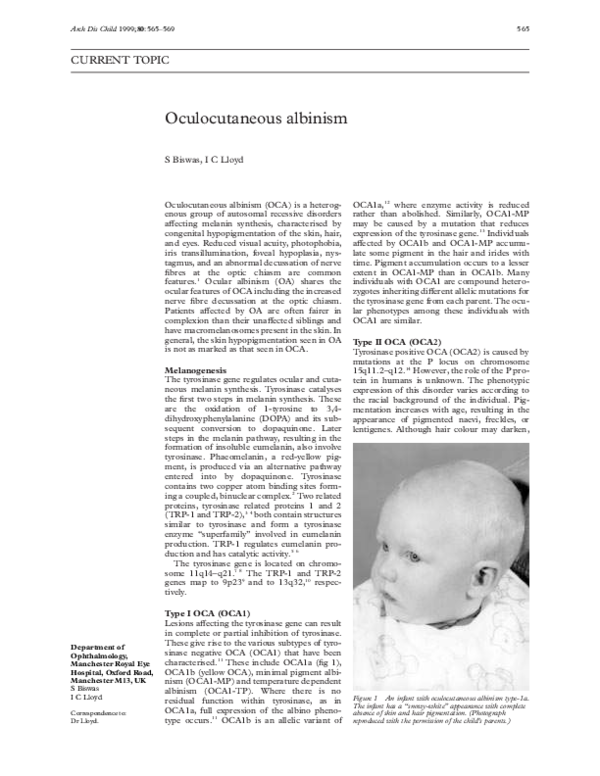 (PDF) Oculocutaneous albinism