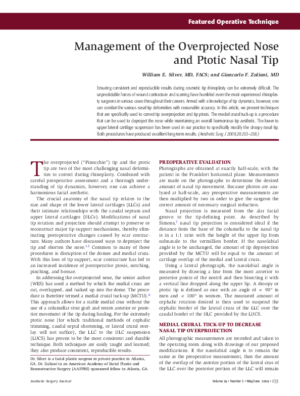 (PDF) Management of the Overprojected Nose and Ptotic Nasal Tip