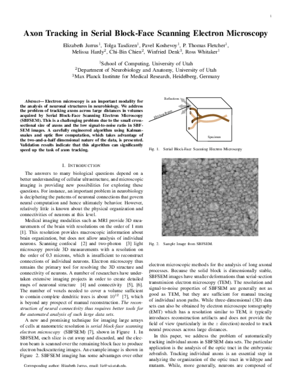 (PDF) Axon Tracking in Serial Block-Face Scanning Electron Microscopy