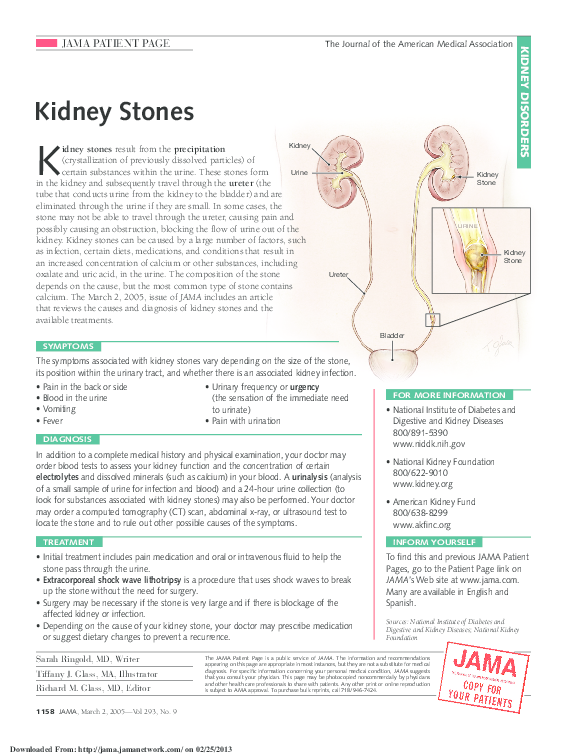 (PDF) Kidney stones