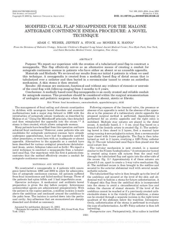 (PDF) Modified Cecal Flap Neoappendix for the Malone Antegrade ...