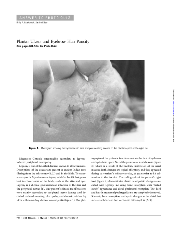 (PDF) Plantar Ulcers and Eyebrow-Hair Paucity