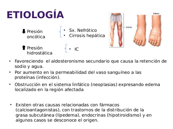 (PPT) Etiologia y Dx EDEMA