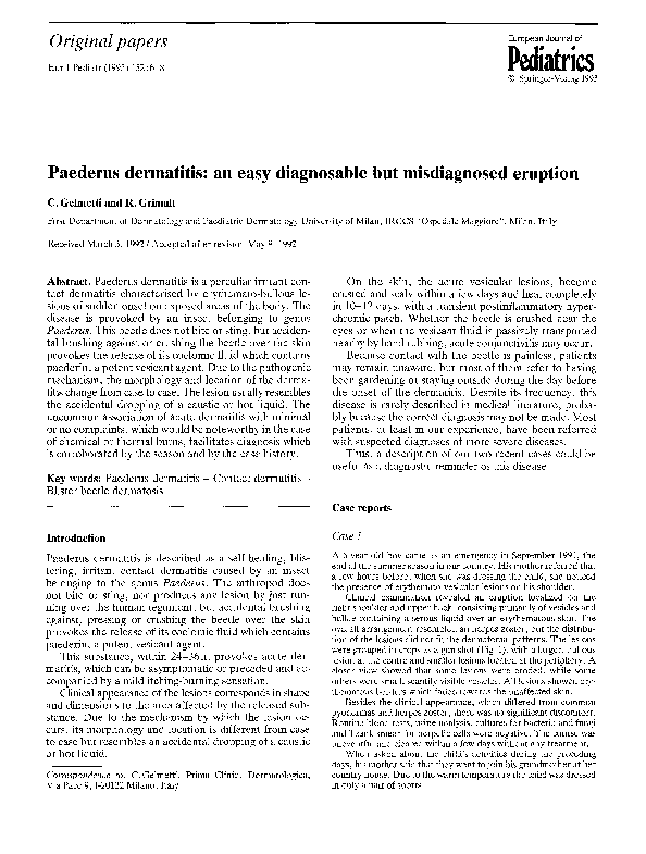 (PDF) Paederus dermatitis: An easy diagnosable but misdiagnosed eruption