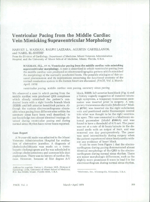 (PDF) Ventricular Pacing from the Middle Cardiac Vein Mimicking ...