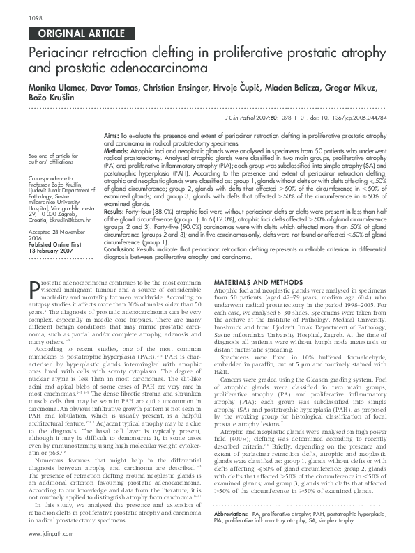 (PDF) Periacinar retraction clefting in proliferative prostatic atrophy ...