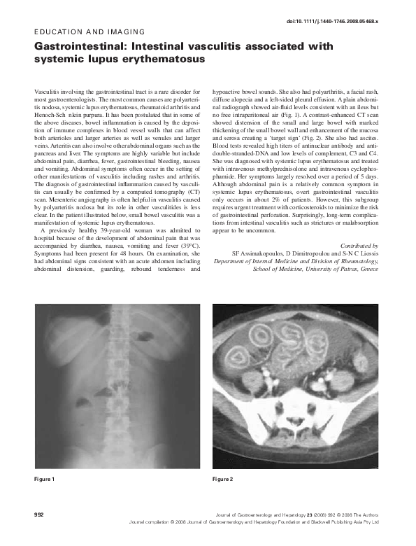 (PDF) Gastrointestinal: Intestinal vasculitis associated with systemic ...