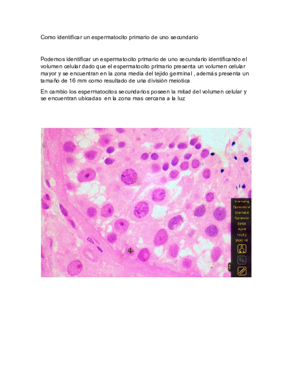 (DOC) Como identificar un espermatocito primario de uno secundario