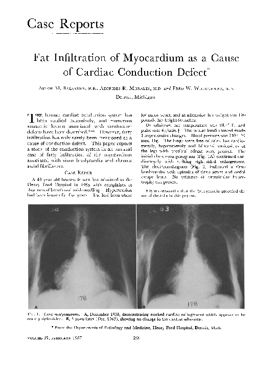 (PDF) Fat infiltration of myocardium as a cause of cardiac conduction ...