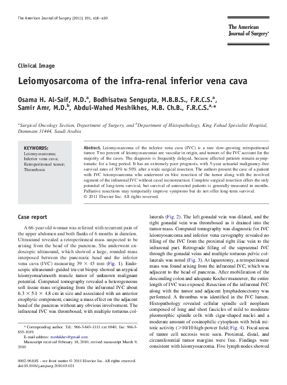 (PDF) Leiomyosarcoma of Inferior Vena Cava and Right Atrium with ...