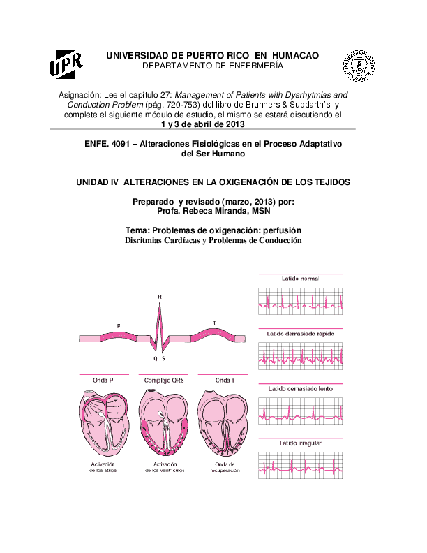 (PDF) Disritmias cardiacas
