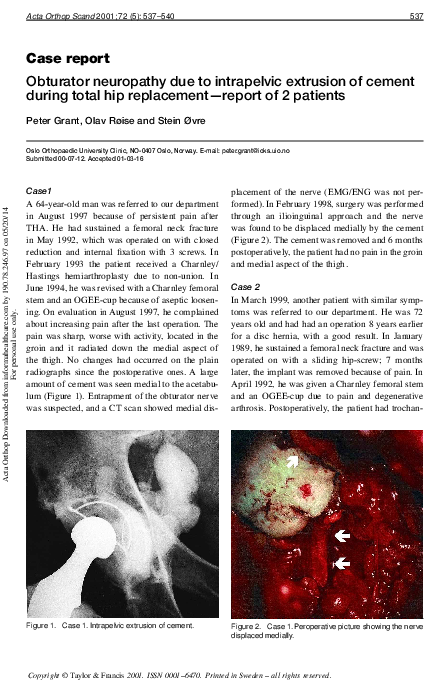 (PDF) Obturator neuropathy due to intrapelvic extrusion of cement ...