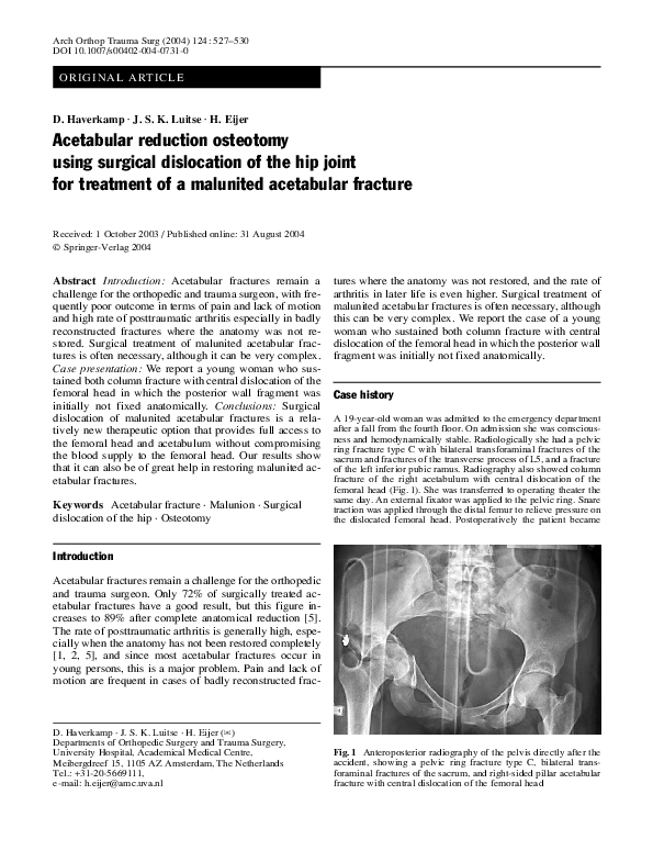 (PDF) Acetabular reduction osteotomy using surgical dislocation of the ...