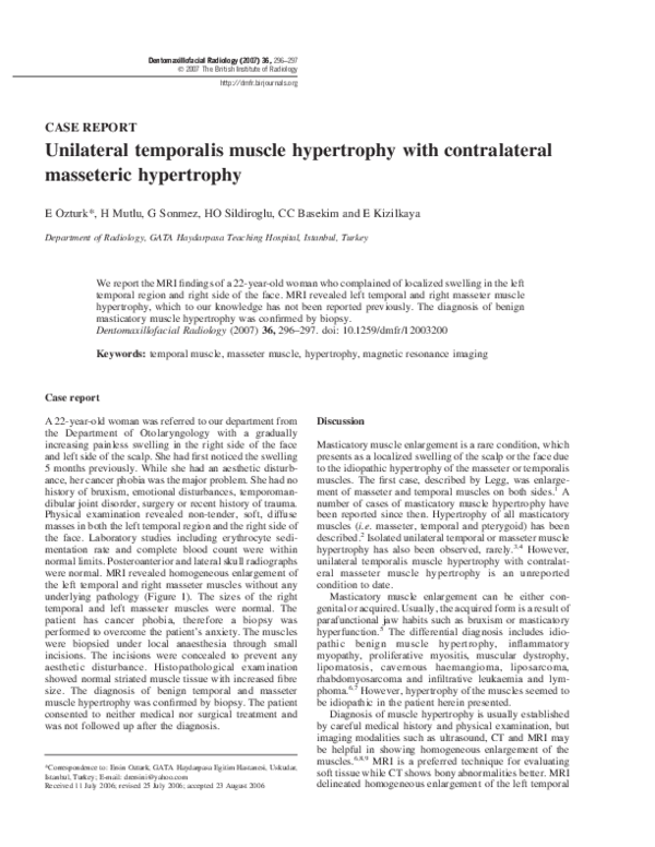 (PDF) Unilateral temporalis muscle hypertrophy with contralateral ...