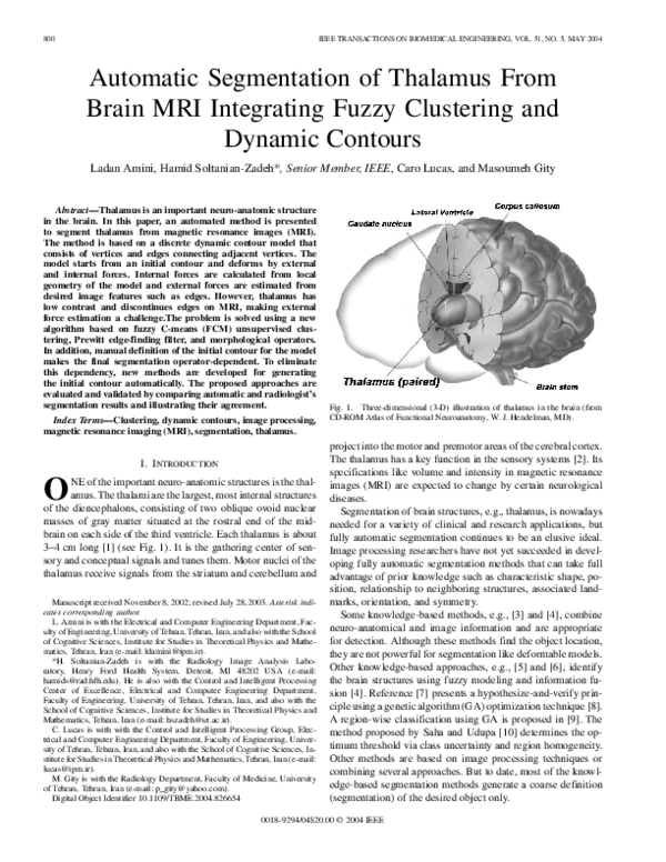 Pdf Automatic Segmentation Of Thalamus From Brain Mri Integrating Fuzzy Clustering And Dynamic