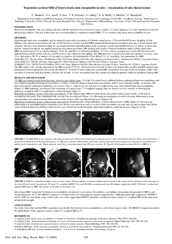 (PDF) Sequential cerebral MRI of listeria brain stem encephalitis in ...