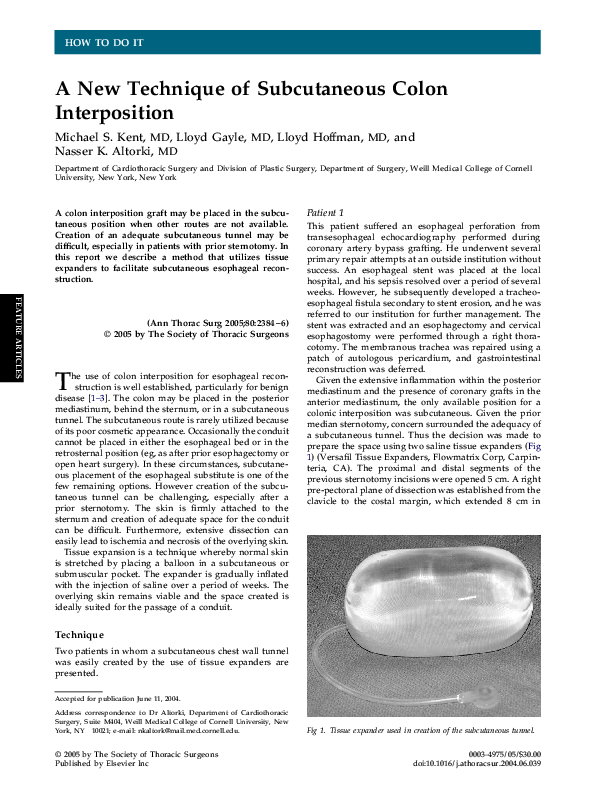 (PDF) A New Technique of Subcutaneous Colon Interposition
