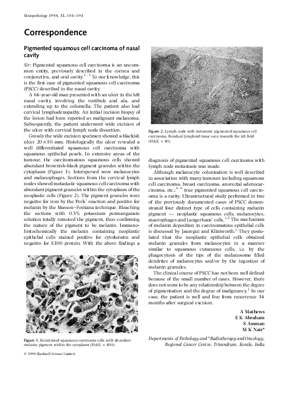 (PDF) Pigmented squamous cell carcinoma of nasal cavity