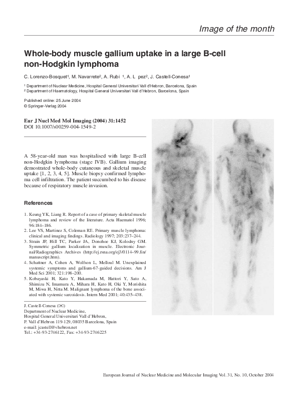 (PDF) Whole-body muscle gallium uptake in a large B-cell non-Hodgkin ...