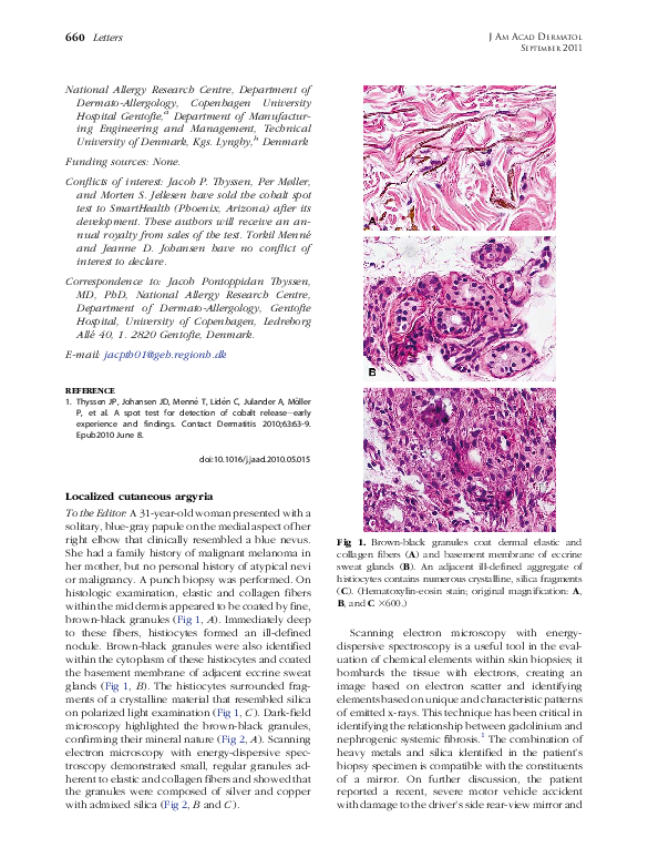 (PDF) Localized cutaneous argyria
