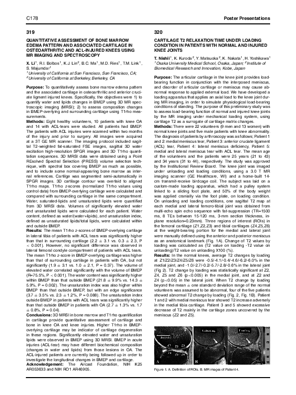 (PDF) 319 QUANTITATIVE ASSESSMENT OF BONE MARROW EDEMA PATTERN AND ASSOCIATED CARTILAGE IN ...