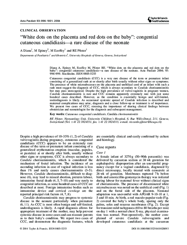 (PDF) “White dots on the placenta and red dots on the baby”: congential ...