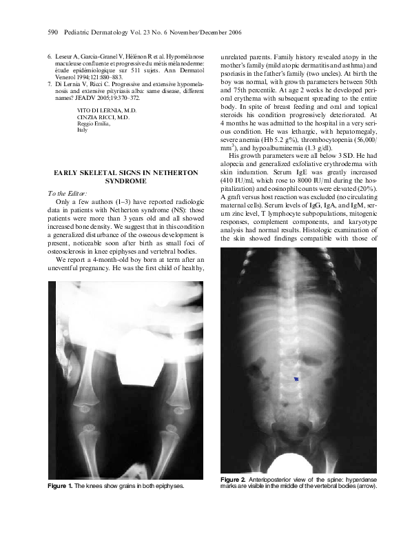 (PDF) Early Skeletal Signs in Netherton Syndrome