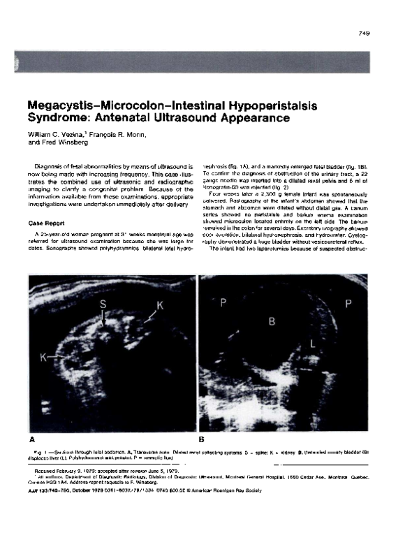 (PDF) Megacystis-Microcolon-Intestinal Hypoperistalsis Syndrome: A Case ...